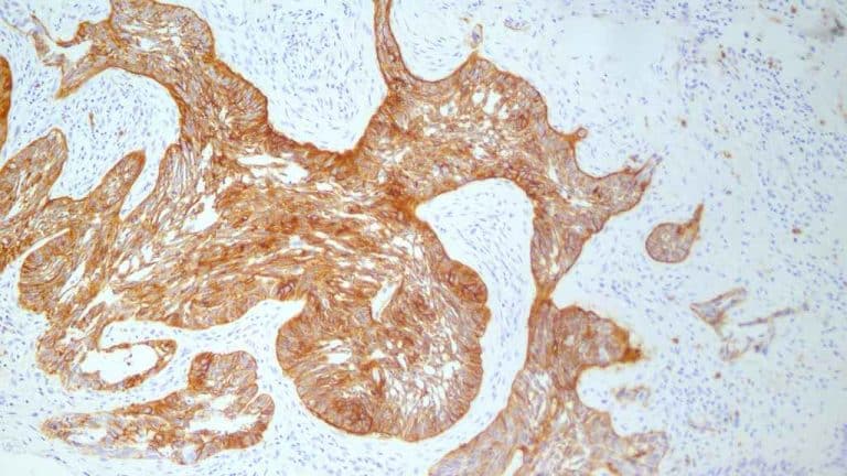 Immunohistochemistry Staining: How It Works | Da-Ta Biotech