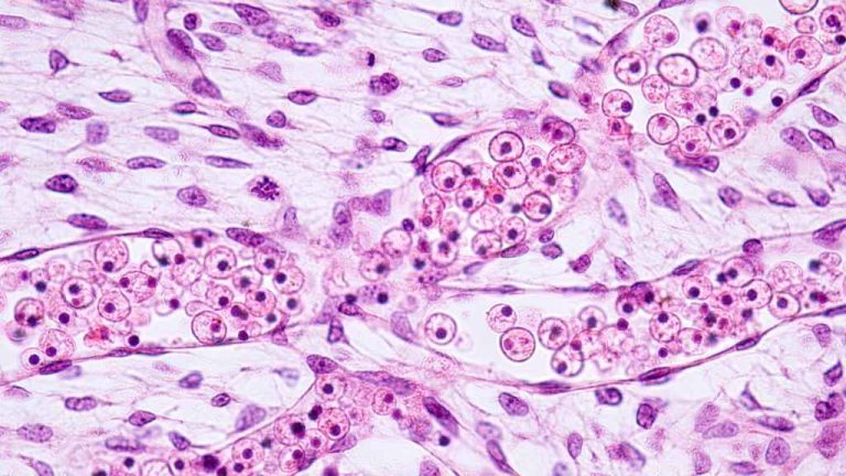 Endothelial Cell Culture: Diagnostic Reaserch Tool | Da-Ta Biotech